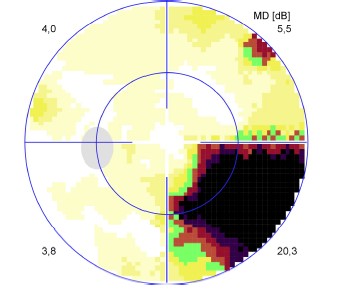 VR-Perimetrie – Talkingeyes & More GmbH